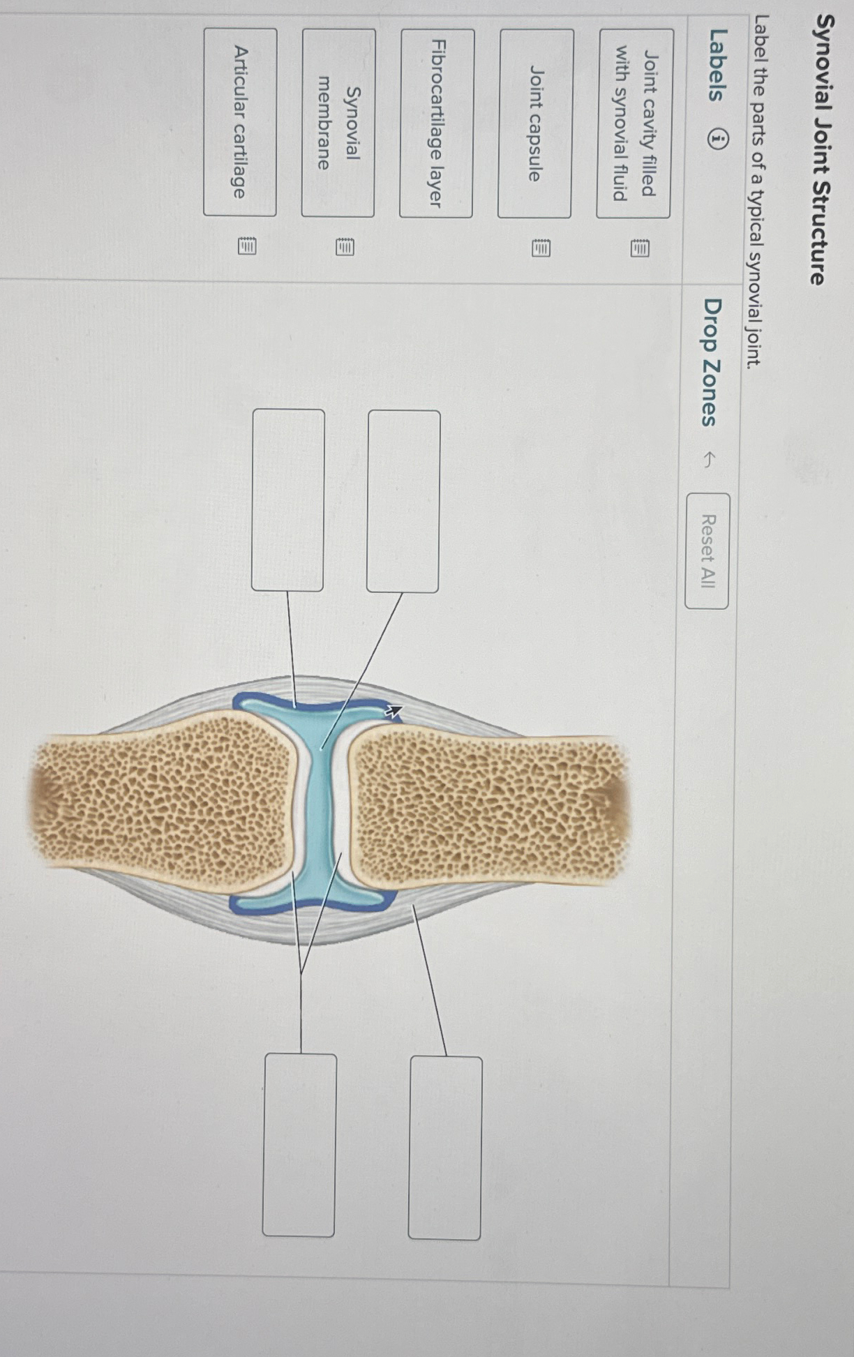 Solved Synovial Joint StructureLabel the parts of a typical | Chegg.com