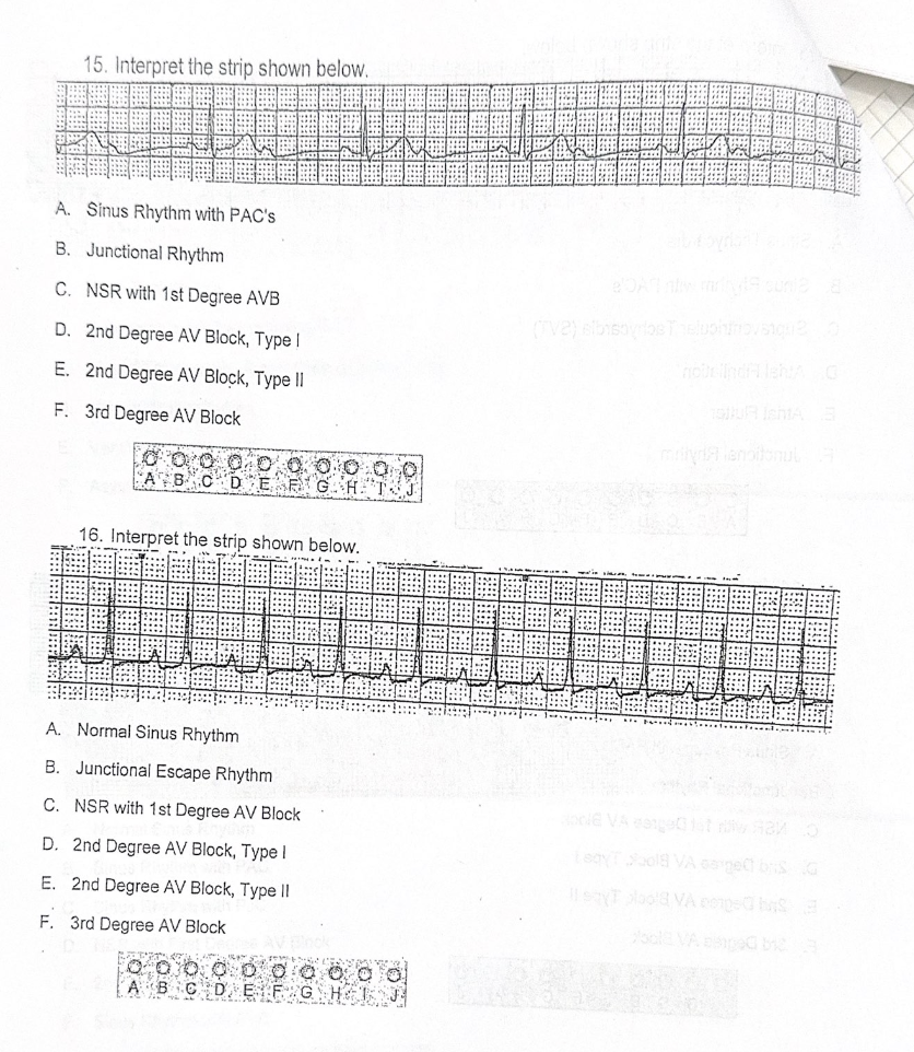 Solved Interpret the strip shown below. A. ﻿Sinus Rhythm | Chegg.com