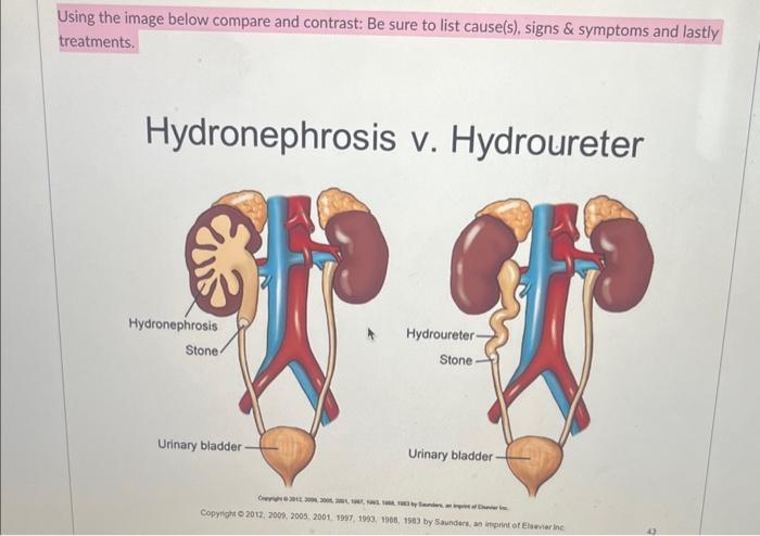 Solved Using the im treatments. Hydronephrosis v. | Chegg.com