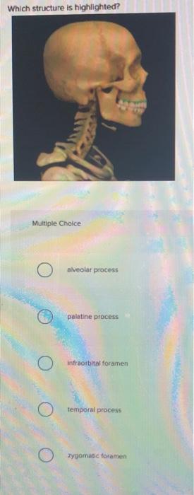 Solved Which structure is highlighted? Multiple Choice | Chegg.com