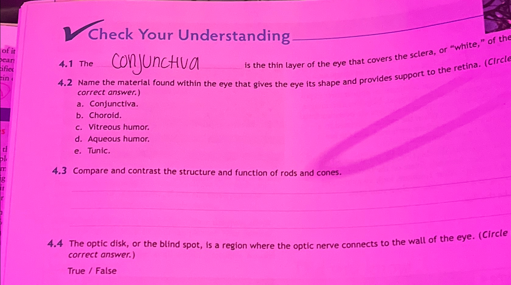 Solved Check Your Understanding4.1 ﻿The conjunctiva is the | Chegg.com