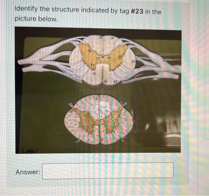 Solved Identify the structure highlighted green in the | Chegg.com