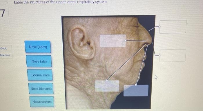 Solved Label the structures of the upper lateral respiratory | Chegg.com