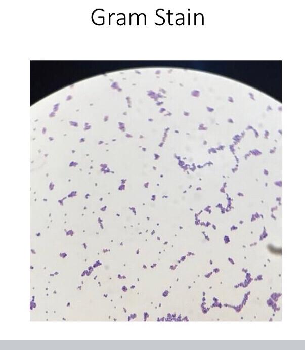 Solved Gram Stain Catalase Test Nitrate Reduction MOL | Chegg.com