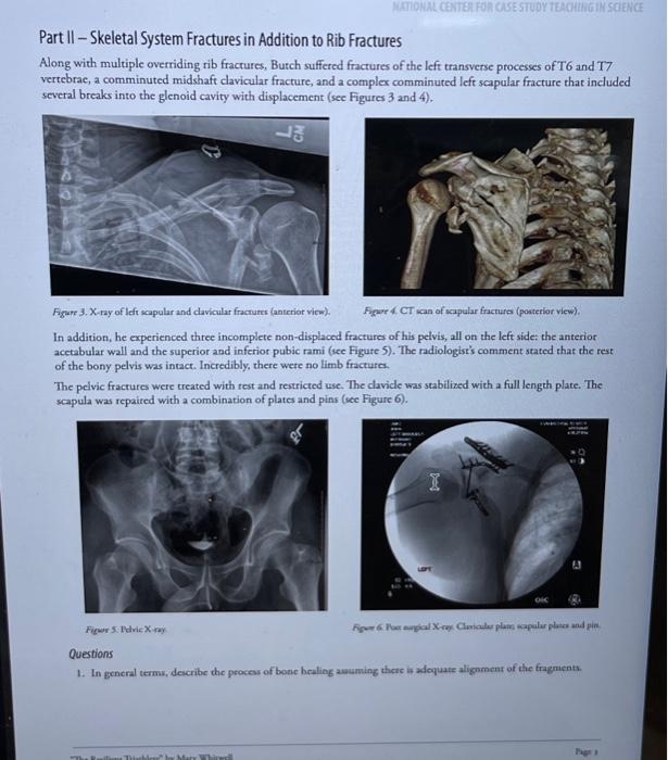 Solved Part II - Skeletal System Fractures in Addition to | Chegg.com