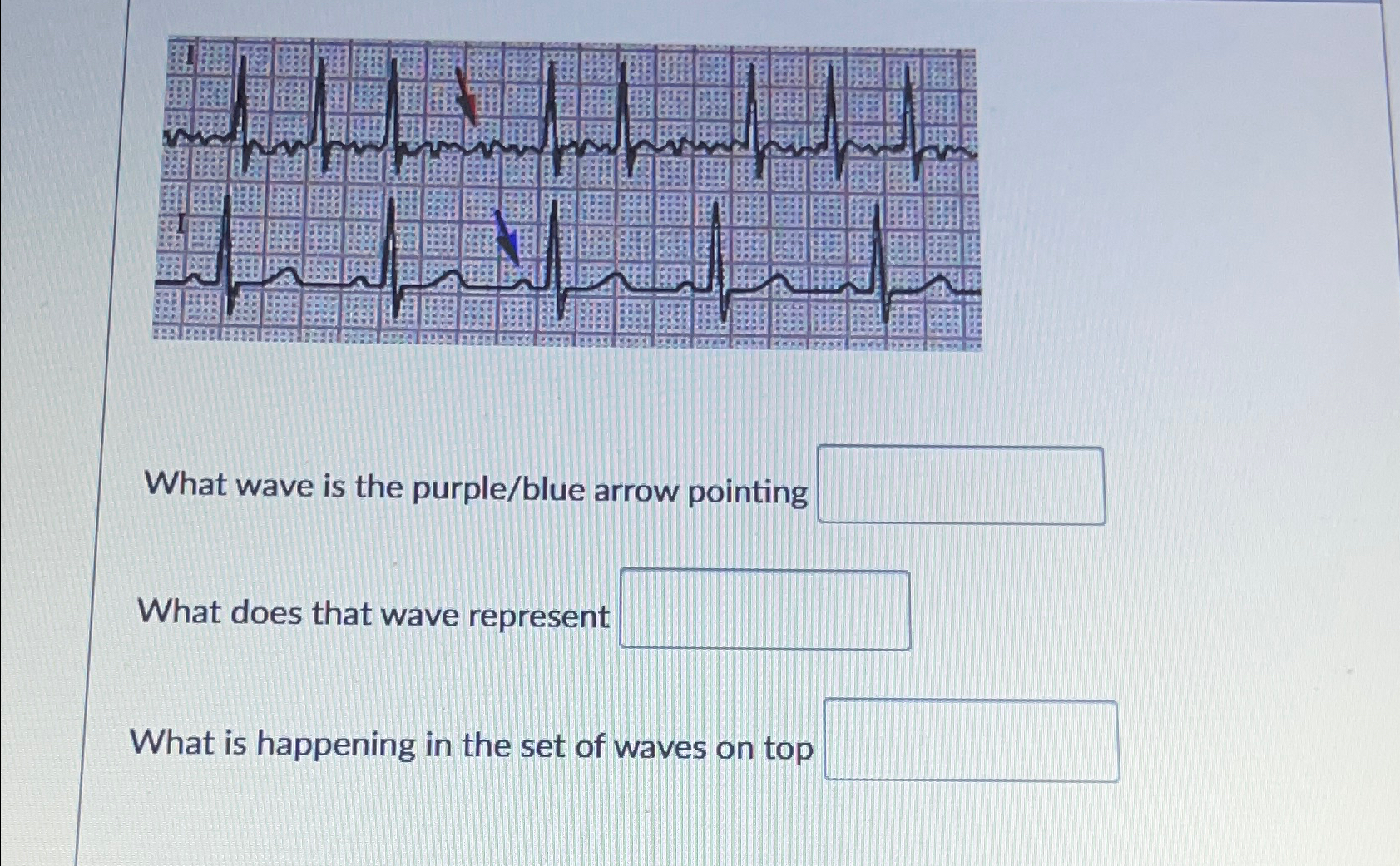 Solved What wave is the purple/blue arrow pointingWhat does | Chegg.com