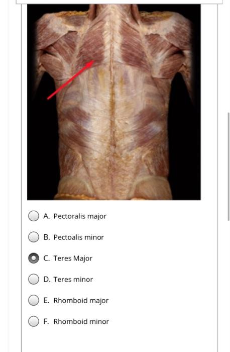 Solved A. Pectoralis major B. Pectoalis minor C. Teres Major | Chegg.com