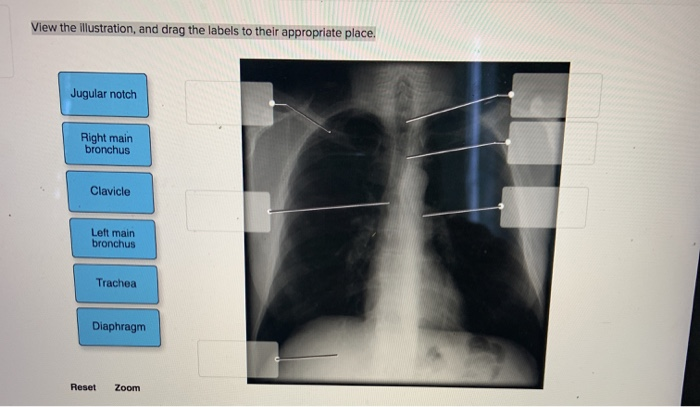 Solved View the illustration, and drag the labels to their | Chegg.com