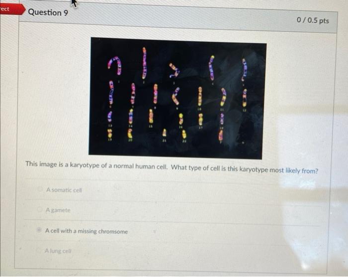 Solved This image is a karyotype of a normal human cell. | Chegg.com