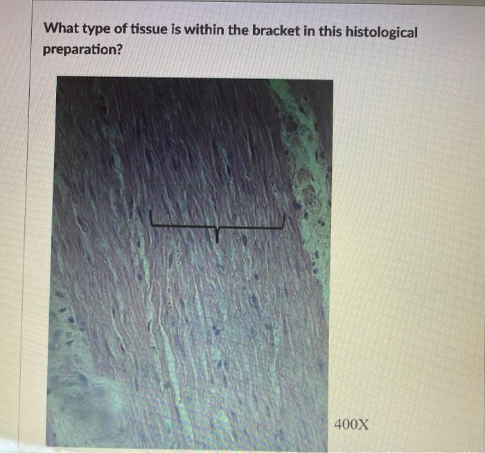 Solved What type of tissue is within the bracket in this | Chegg.com
