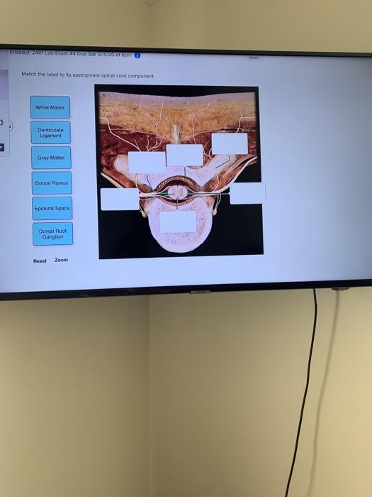 Solved DISPUTER SOFU Match the label to its appropriate | Chegg.com
