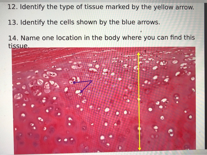 Solved 1. Identify the type of tissue marked by the yellow | Chegg.com