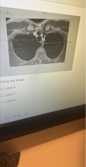 Solved Using the image: 1. Label A 2. Label C 3. Label | Chegg.com