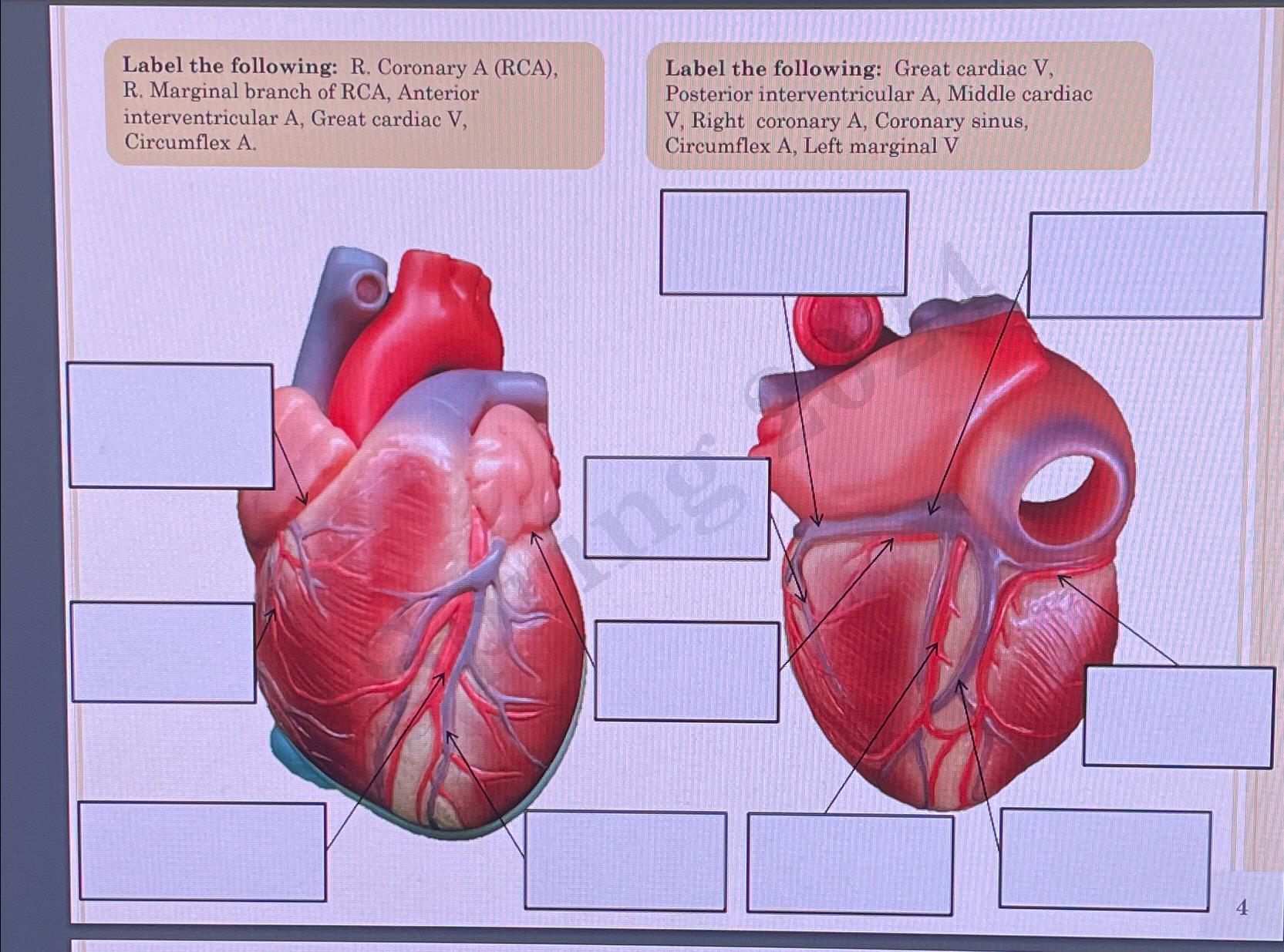 Solved Label the following: R. ﻿Coronary A (RCA), ﻿R. | Chegg.com