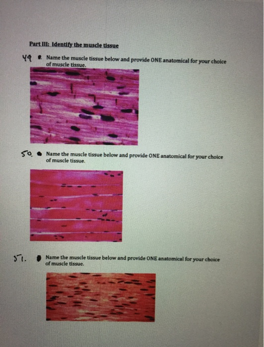 Solved Part III: Identify the muscle tissue 49 . Name the | Chegg.com