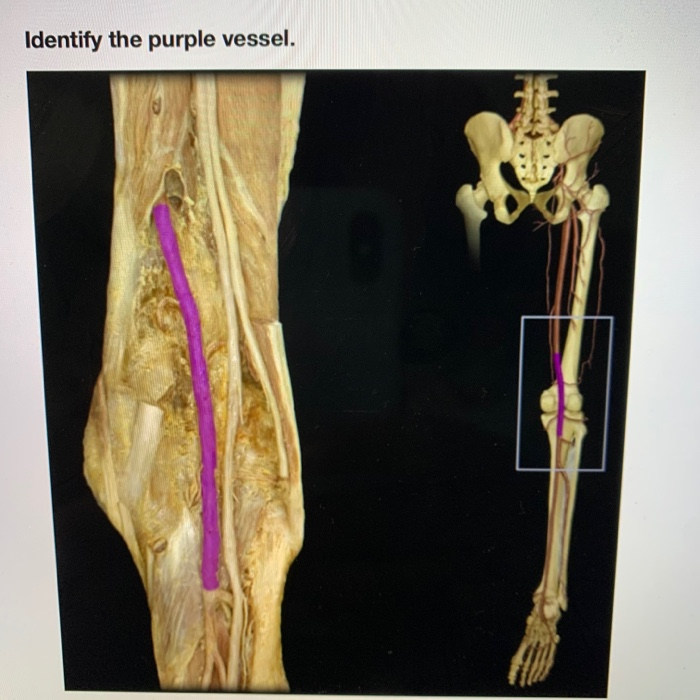 Solved Identify the purple vessel. | Chegg.com