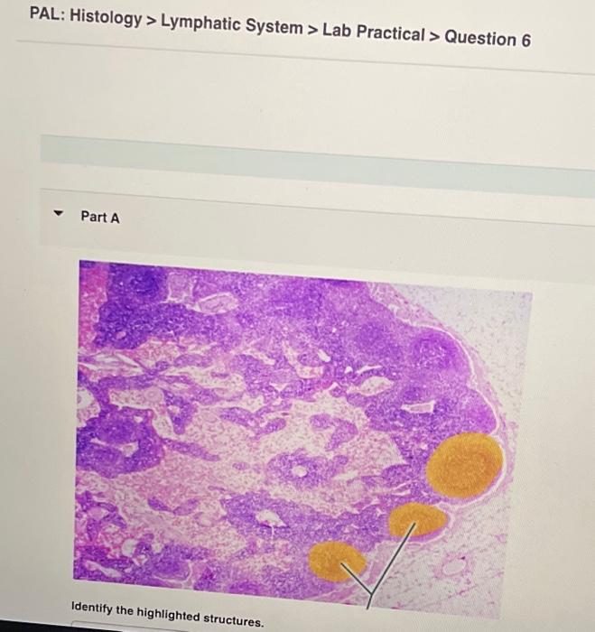 Solved PAL: Histology > Lymphatic System > Lab Practical > | Chegg.com