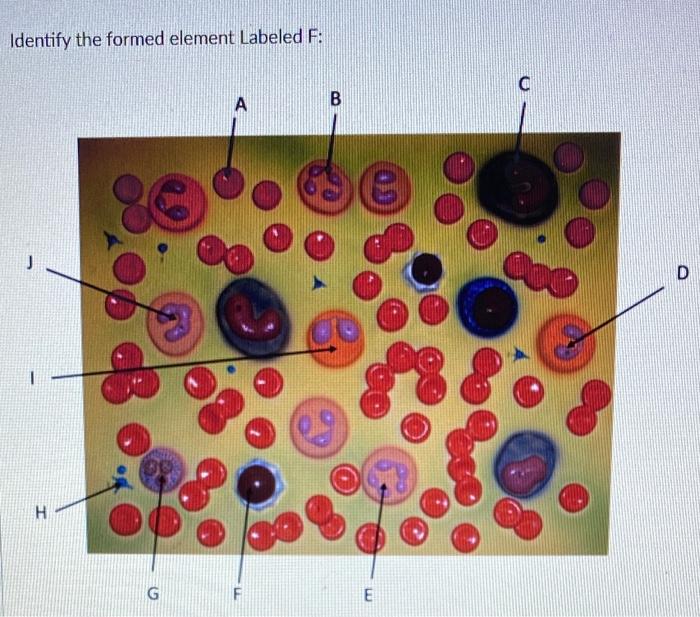 Solved Identify the formed element Labeled F: C A B J D G F | Chegg.com