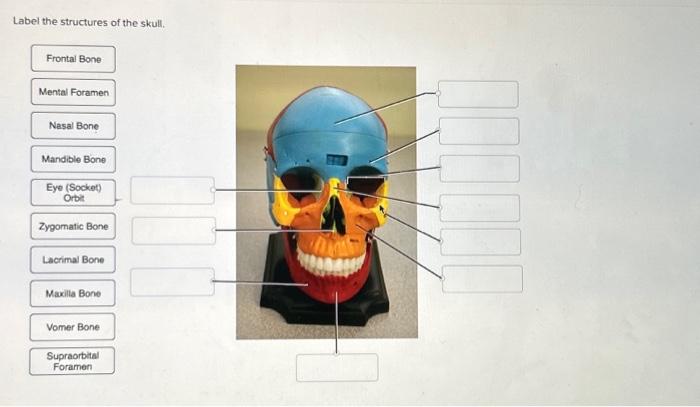 Solved Label the structures of the skull. Frontal Bone | Chegg.com