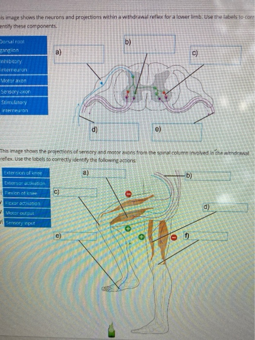 Solved PUPILLARY LIGHT REFLEX 07: The consensual light | Chegg.com