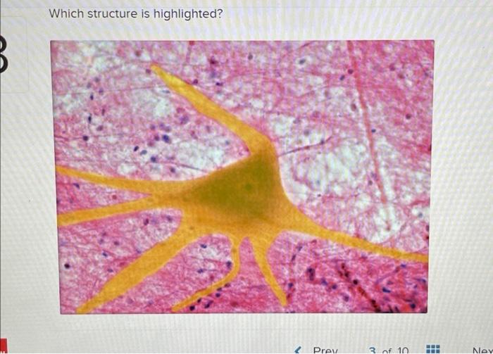 Solved Which structure is highlighted? Prev 3 of 10 Ney | Chegg.com
