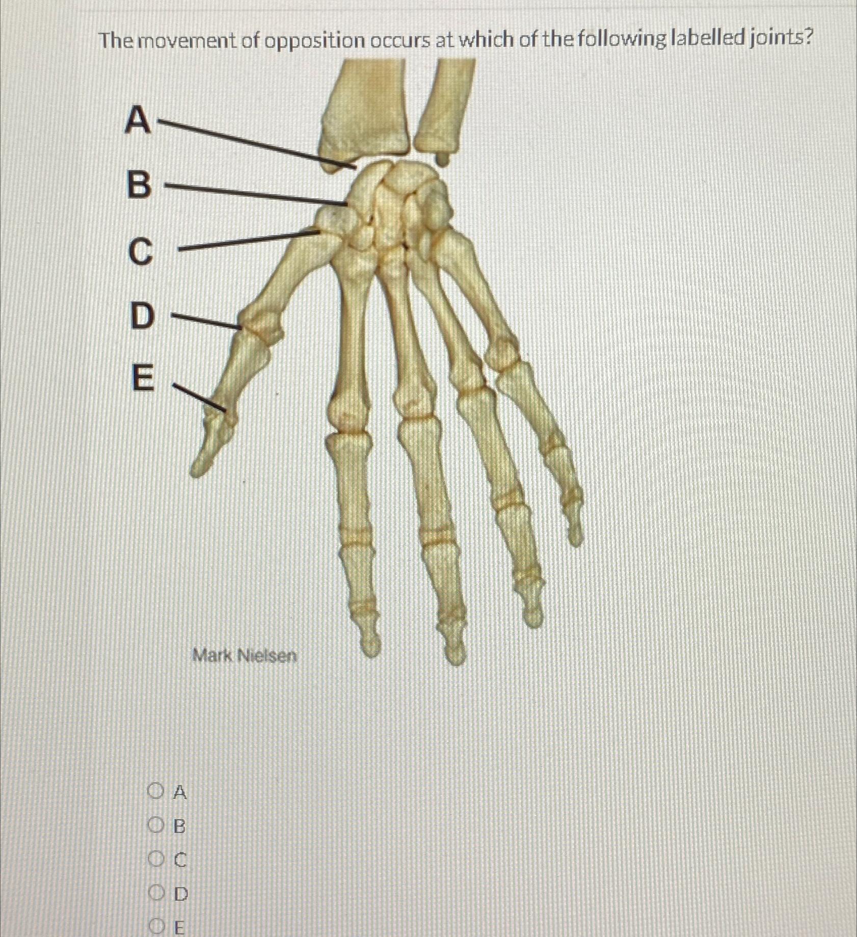 Solved The movement of opposition occurs at which of the | Chegg.com