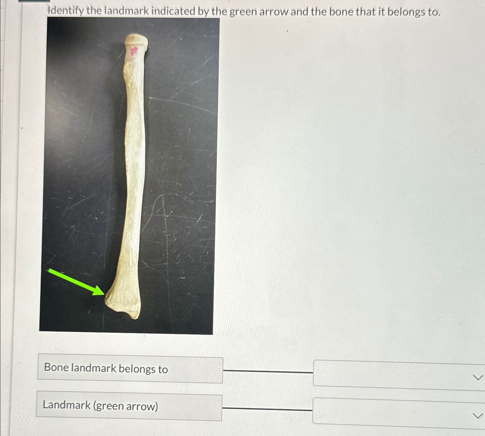 Solved Identify the landmark indicated by the green arrow | Chegg.com