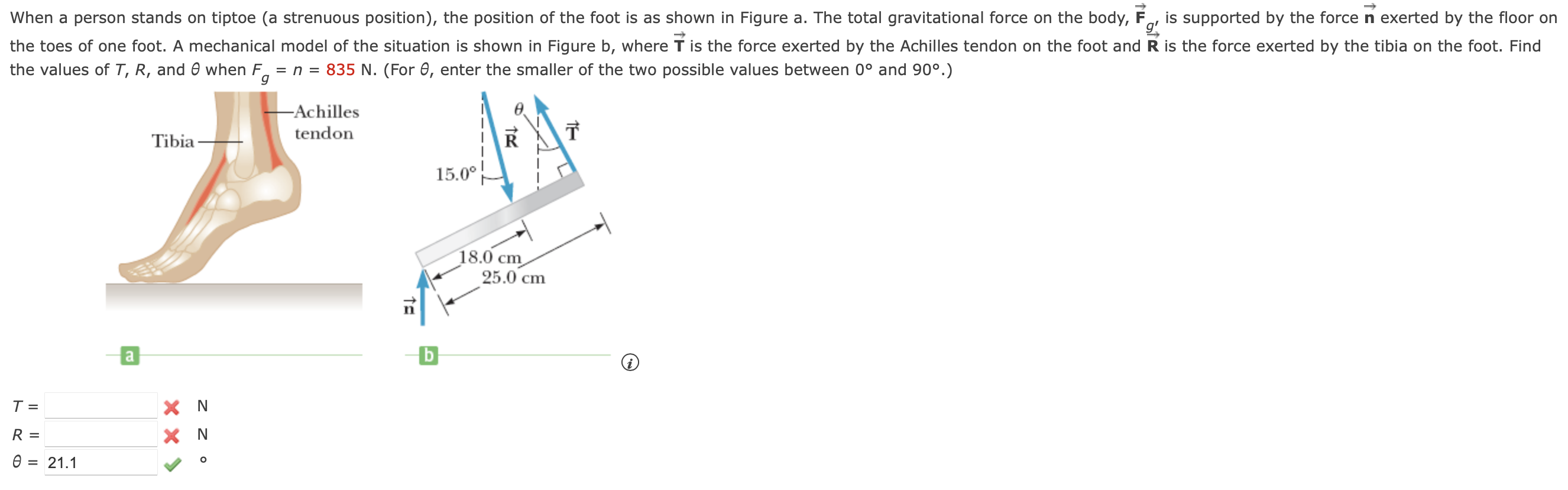 Solved the values of T,R, ﻿and θ ﻿when Fg=n=835N. (For θ, | Chegg.com