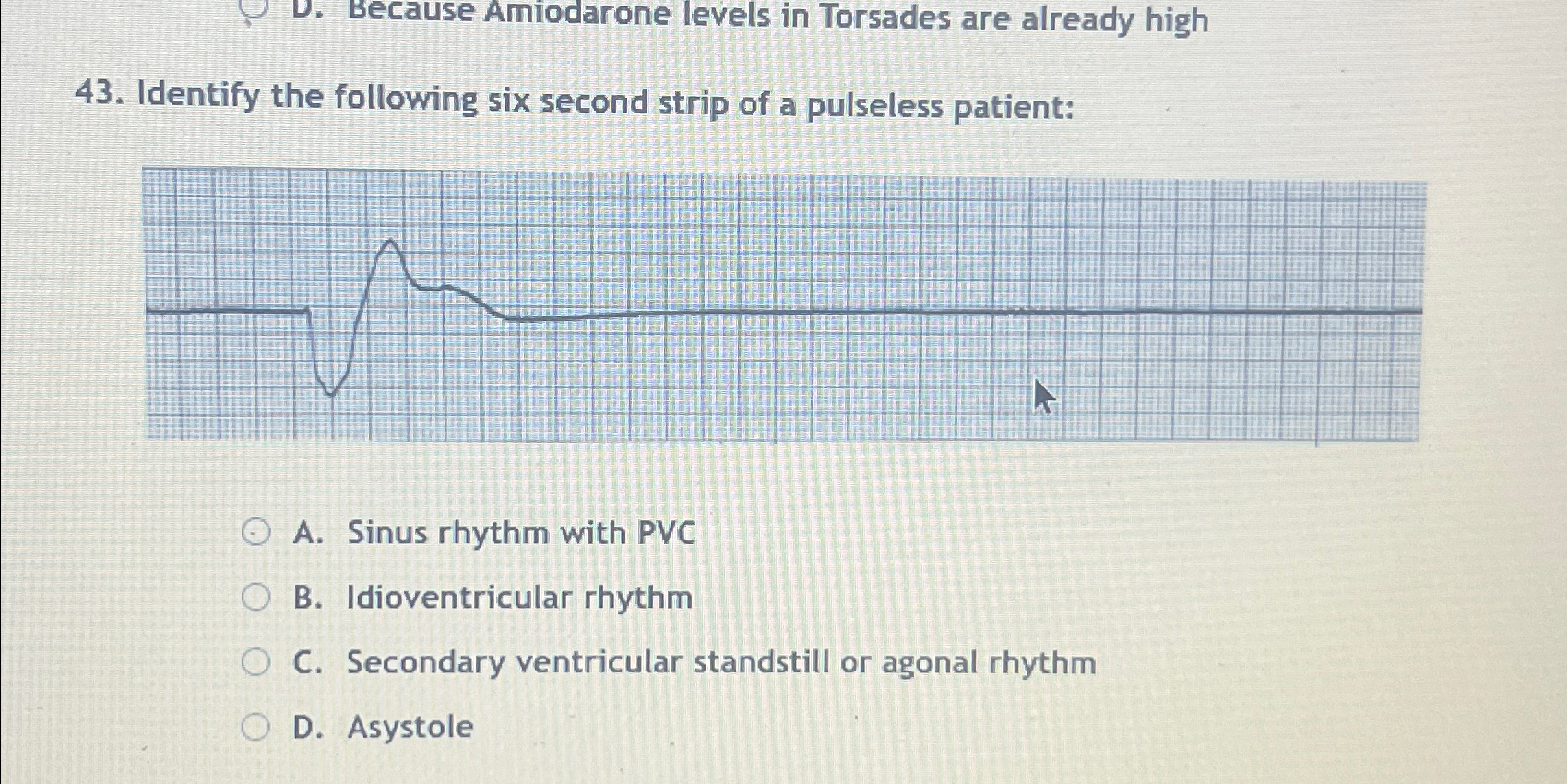 Solved 43. ﻿Identify the following six second strip of a | Chegg.com