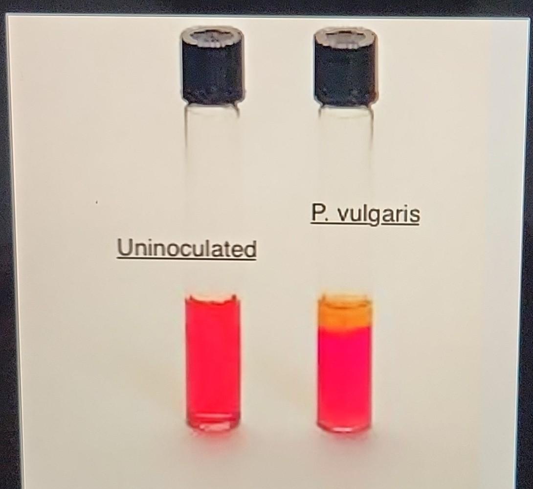 UREA AGAR P. vulgaris P. aeruginosa Uninoculated | Chegg.com