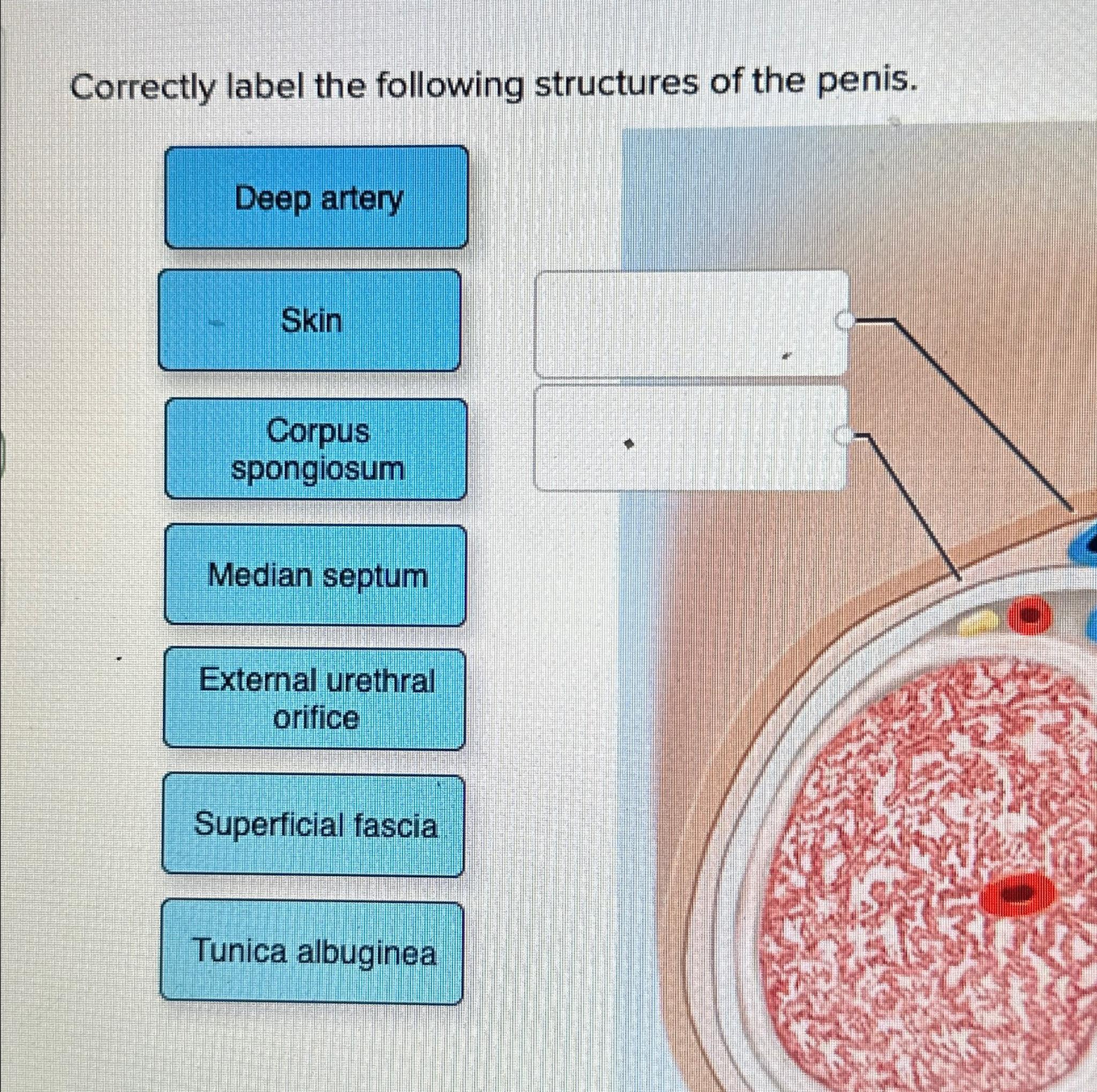 Correctly label the following structures of the | Chegg.com