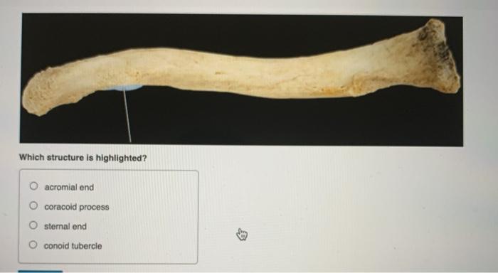 Solved Which structure is highlighted? O acromial end O | Chegg.com