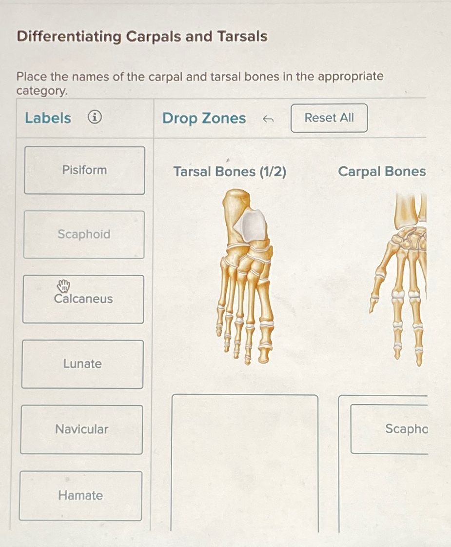 Solved Differentiating Carpals and TarsalsPlace the names of | Chegg.com