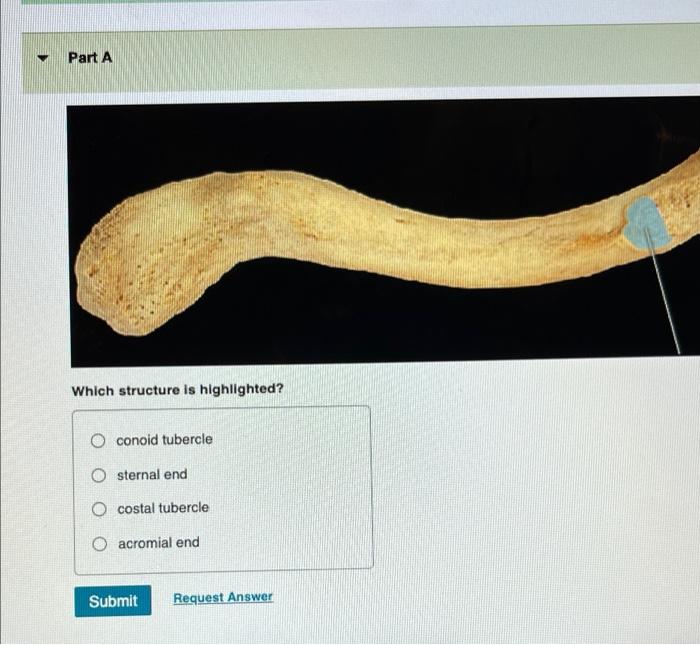 Solved Part A Which structure is highlighted? O conoid | Chegg.com