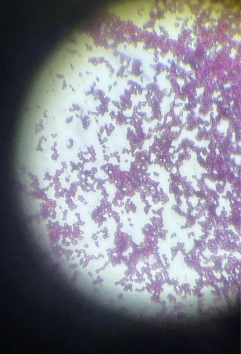 Solved Based on the quad streak and gram stain pictures, | Chegg.com
