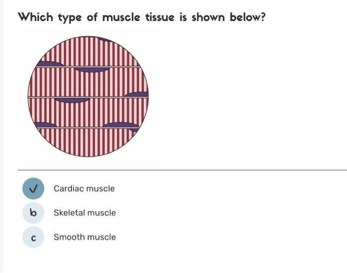 Solved Which type of muscle tissue is shown below? Cardiac | Chegg.com