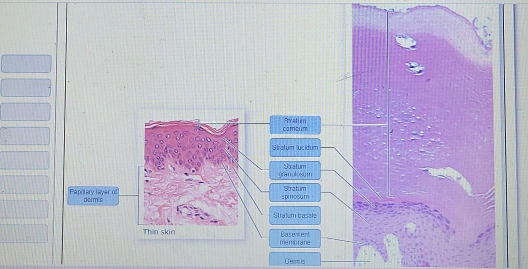 Solved Stratum comeum Stratum lucidum Stratum granulosum | Chegg.com