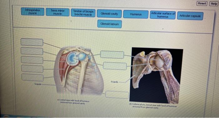 Solved Articular cartilage Articular capsule Joint space | Chegg.com