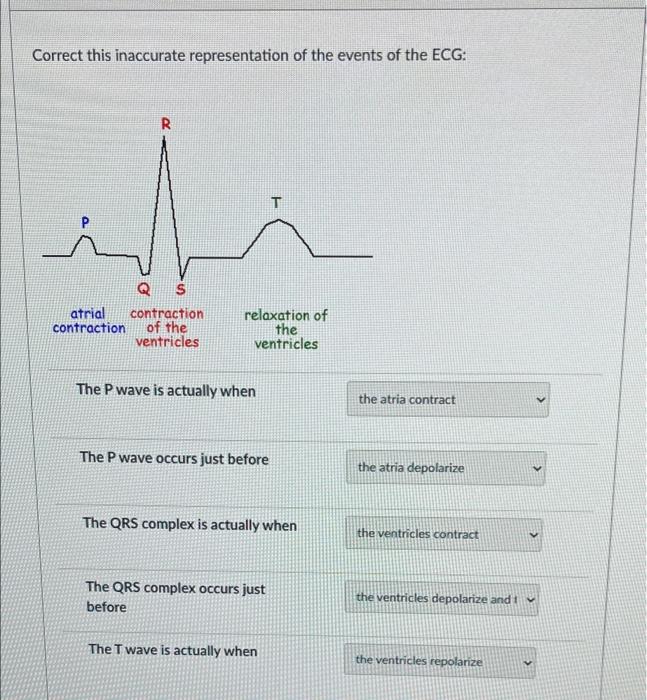 Solved Correct this inaccurate representation of the events | Chegg.com