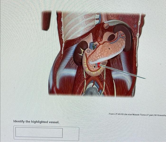 Solved Identify the highlighted vessel. From LT-VA10 | Chegg.com