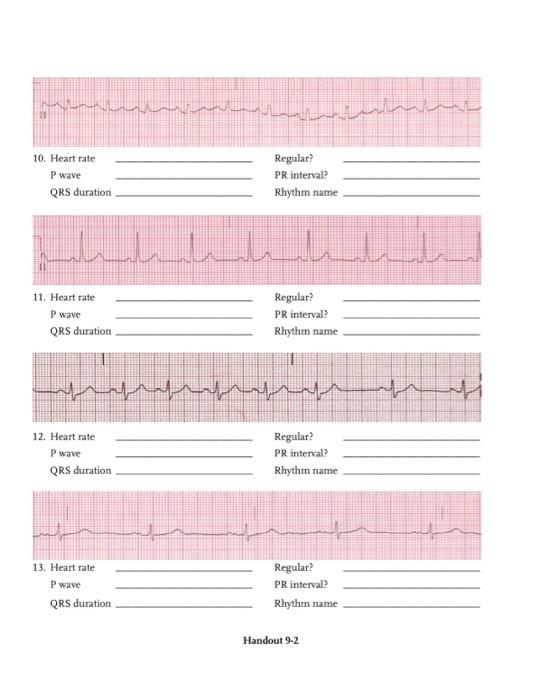 11. Heart rate Regular? P wave PR interval? QRS | Chegg.com