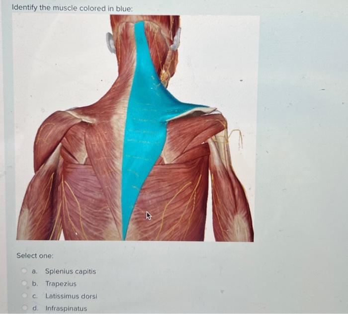 Solved Identify the muscle colored in blue: Select one: a. | Chegg.com Solved Identify the muscle colored in blue: Select one: a. | Chegg.com