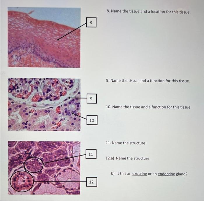 Solved 1. Name this tissue and a location for the tissue. 2. | Chegg.com