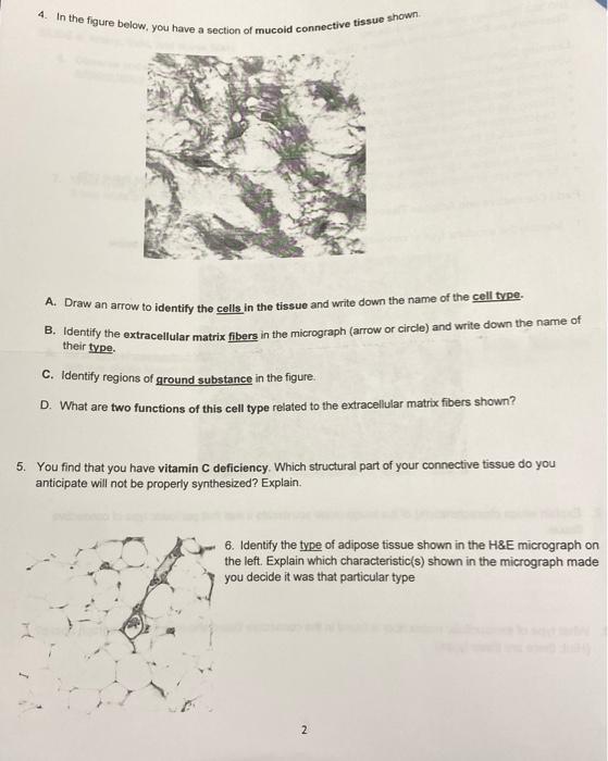 Solved 4. In the figure below, you have a section of mucoid | Chegg.com