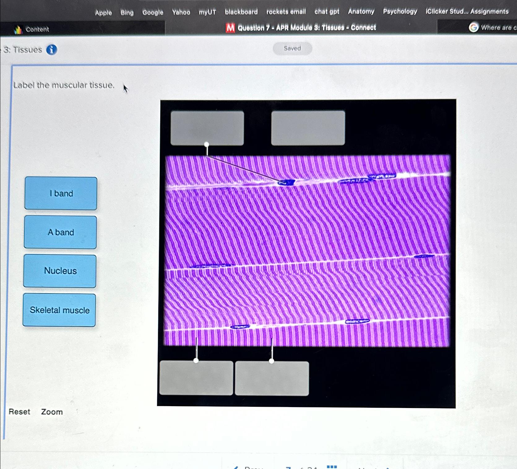 Solved 3: TissuesLabel the muscular tissue.Skeletal | Chegg.com