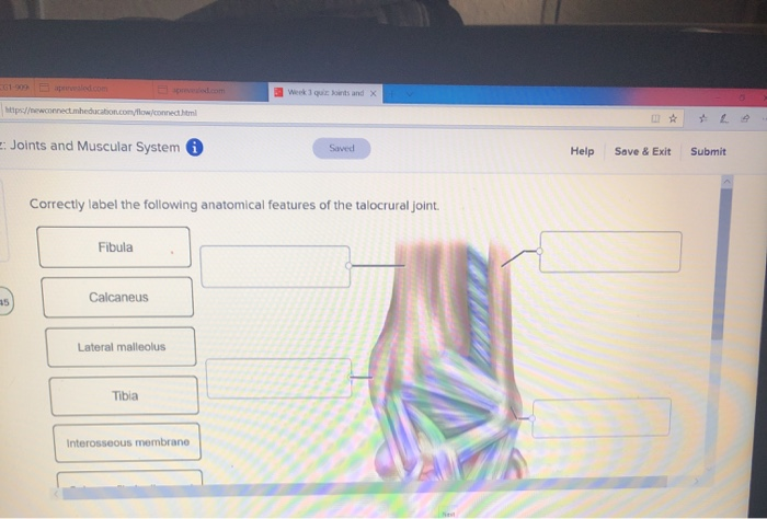 Solved: M Wenechcbon.comconnect Joints And Muscular System... | Chegg.com