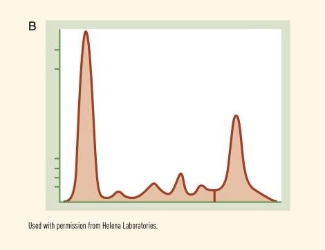 Compare the image of Guillermo’s electropherogram | Chegg.com