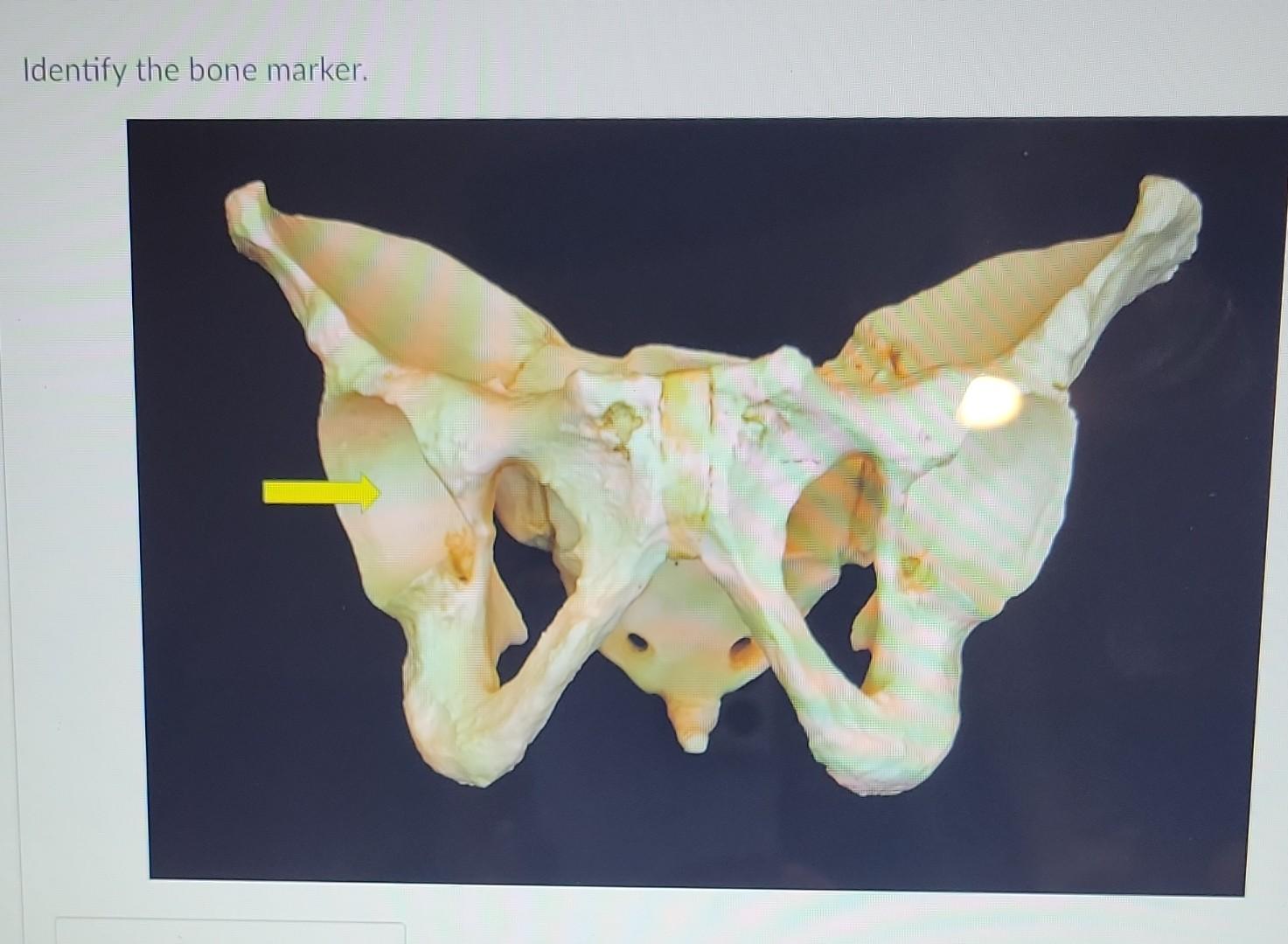 Solved Identify the bone marker indicated by the red | Chegg.com