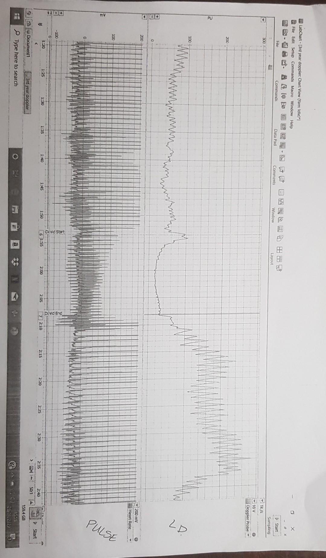 [E LabChart - [3rd year doppler: Chart View (Yam | Chegg.com