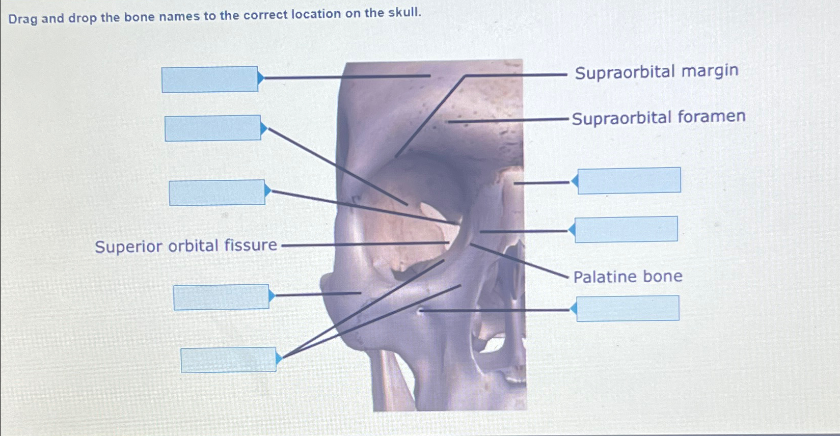 Solved Drag and drop the bone names to the correct location | Chegg.com